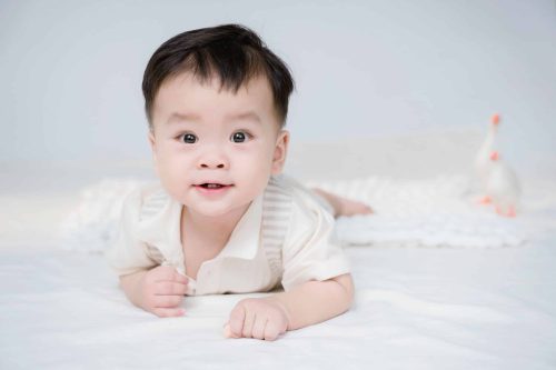 What is Costello Syndrome? - Goally