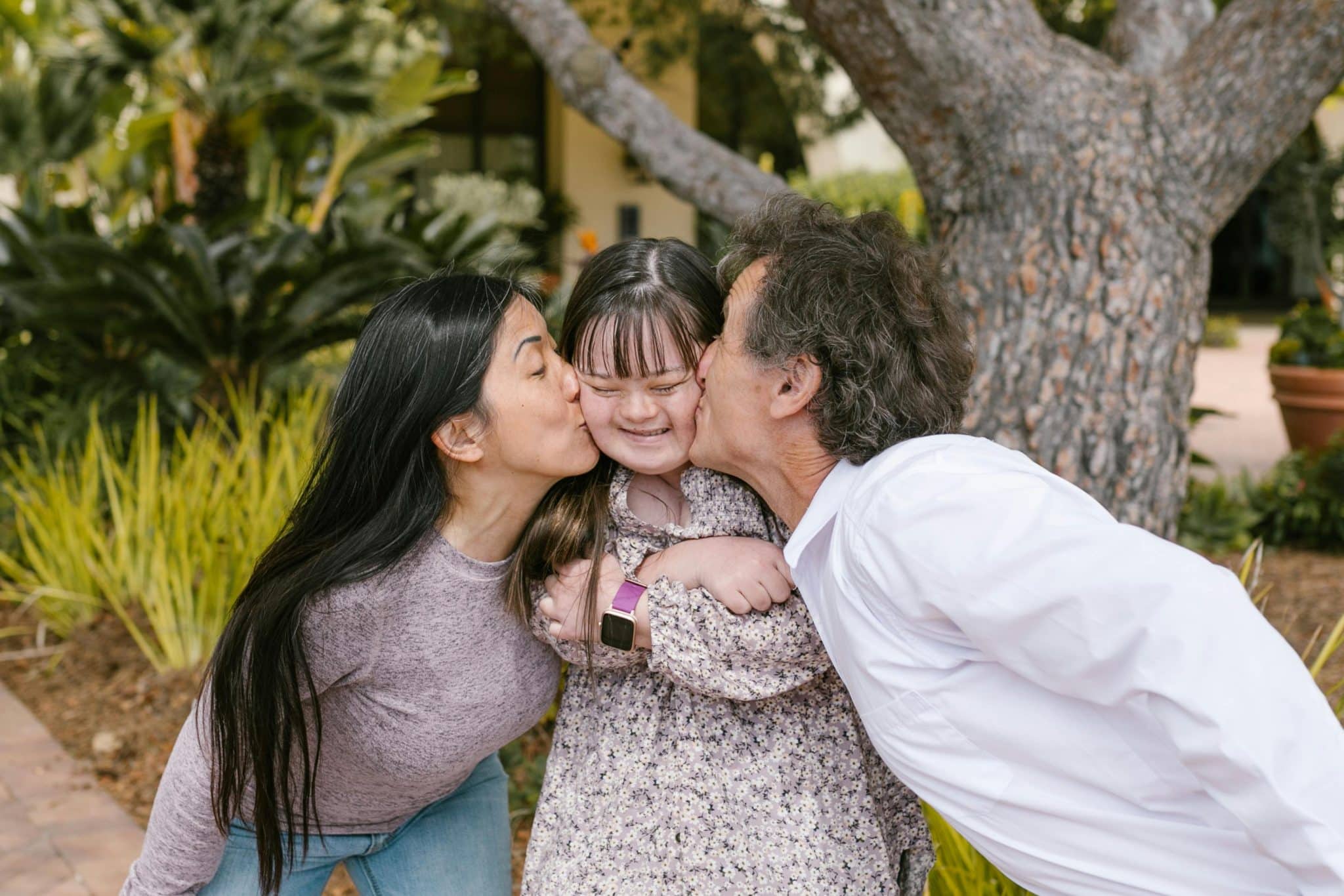 What is Downs Chromosome Abnormality? - Goally
